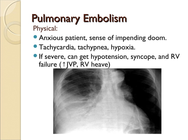 24 approach to chest pain | PPT