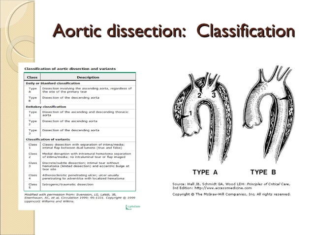 24 approach to chest pain | PPT