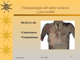 24. Dolor Toracico Y Precordial | PPT
