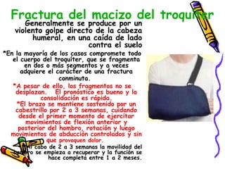 24. fractura extremidad superior de humero | PPT