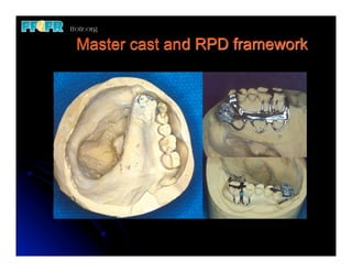 24.(new)mfp defects and rpd design | PDF
