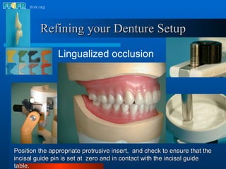 24.refine denture setup | PPT