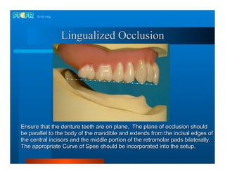 24.refine denture setup | PDF