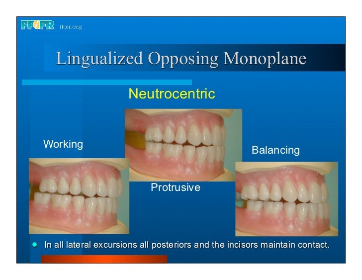 24.refine denture setup