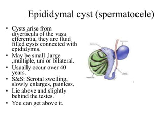 Scrotal Swelling and differential diagnosis | PPT