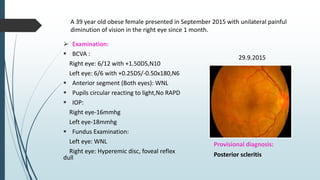 Diagnostic Dilemma | PPTX