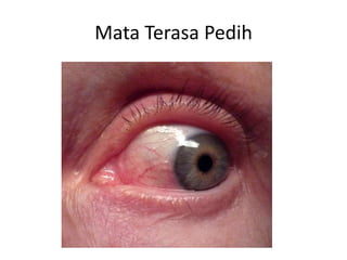 Tanda-tanda-Penyakit-Konjunktivitis.pptx