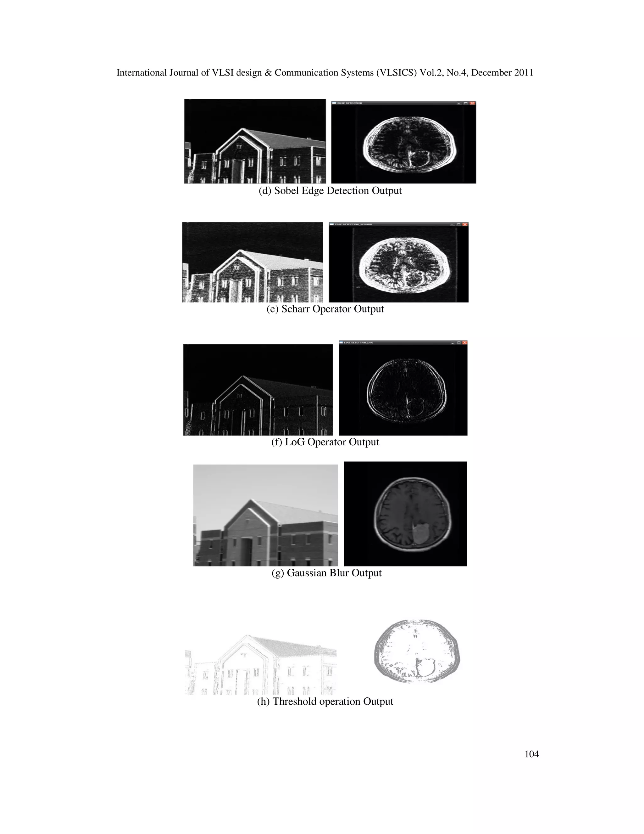 An Efficient Fpga Implemenation Of Mri Image Filtering And Tumour Characterization Using Xilinx 5808