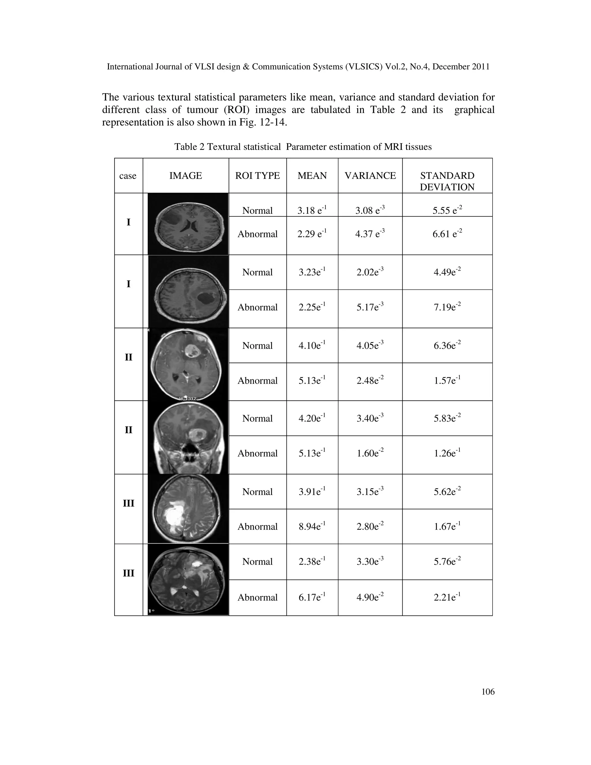 An Efficient Fpga Implemenation Of Mri Image Filtering And Tumour Characterization Using Xilinx