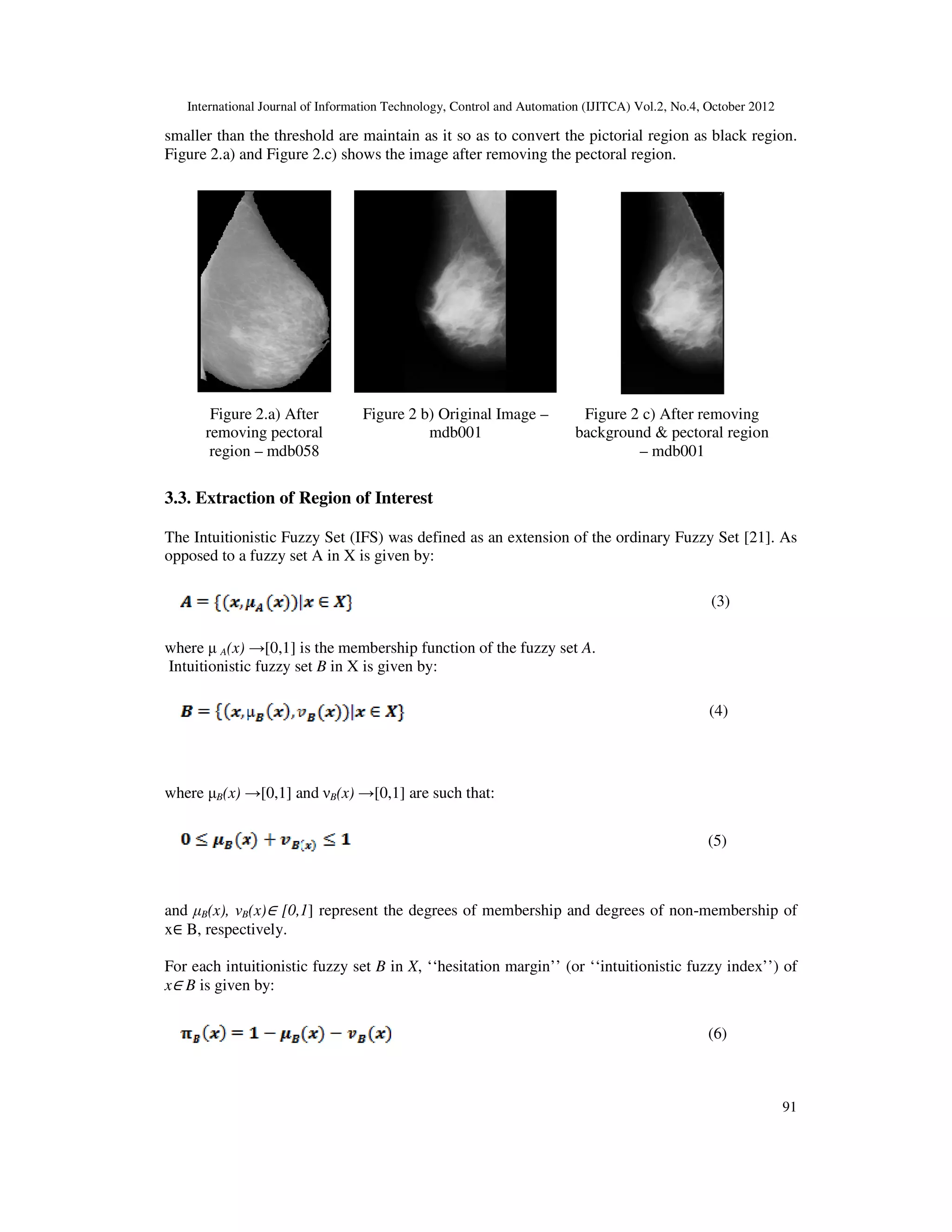 Computer Aided System for Detection and Classification of Breast Cancer | PDF | Photo Editing ...