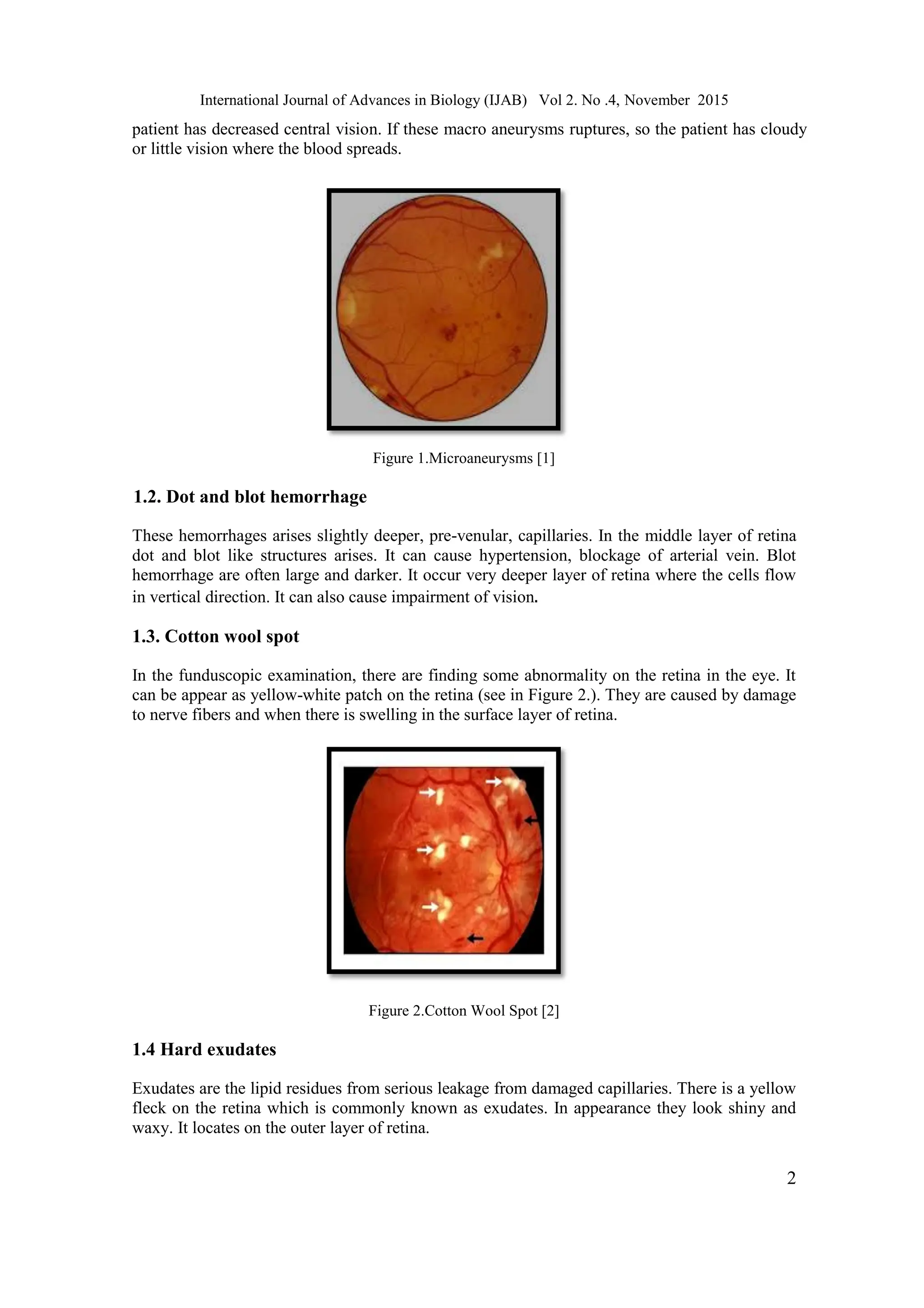 Exudates Detection From Digital Fundus Image Of Diabetic Retinopathy Pdf
