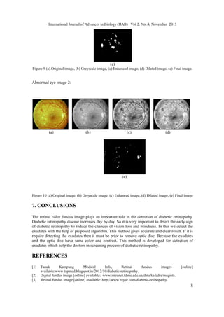 EXUDATES DETECTION FROM DIGITAL FUNDUS IMAGE OF DIABETIC RETINOPATHY | PDF