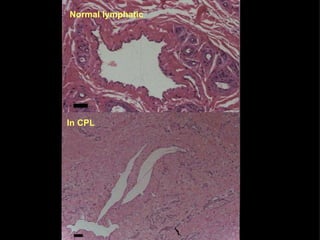 CPL in draft horses | PPT