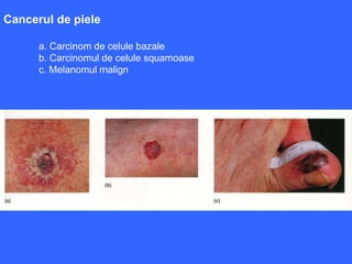 sistemul-tegumentar-ppt | PPT