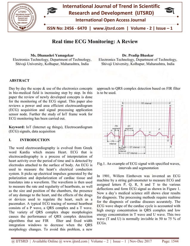 Real time ECG Monitoring: A Review | PDF