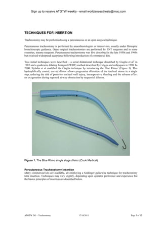 Tracheostomy overview | PDF
