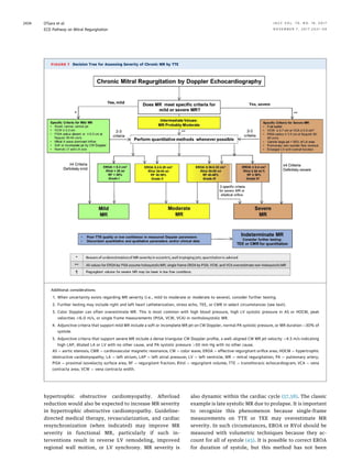 management Mitral valve Regurgitaion | PDF