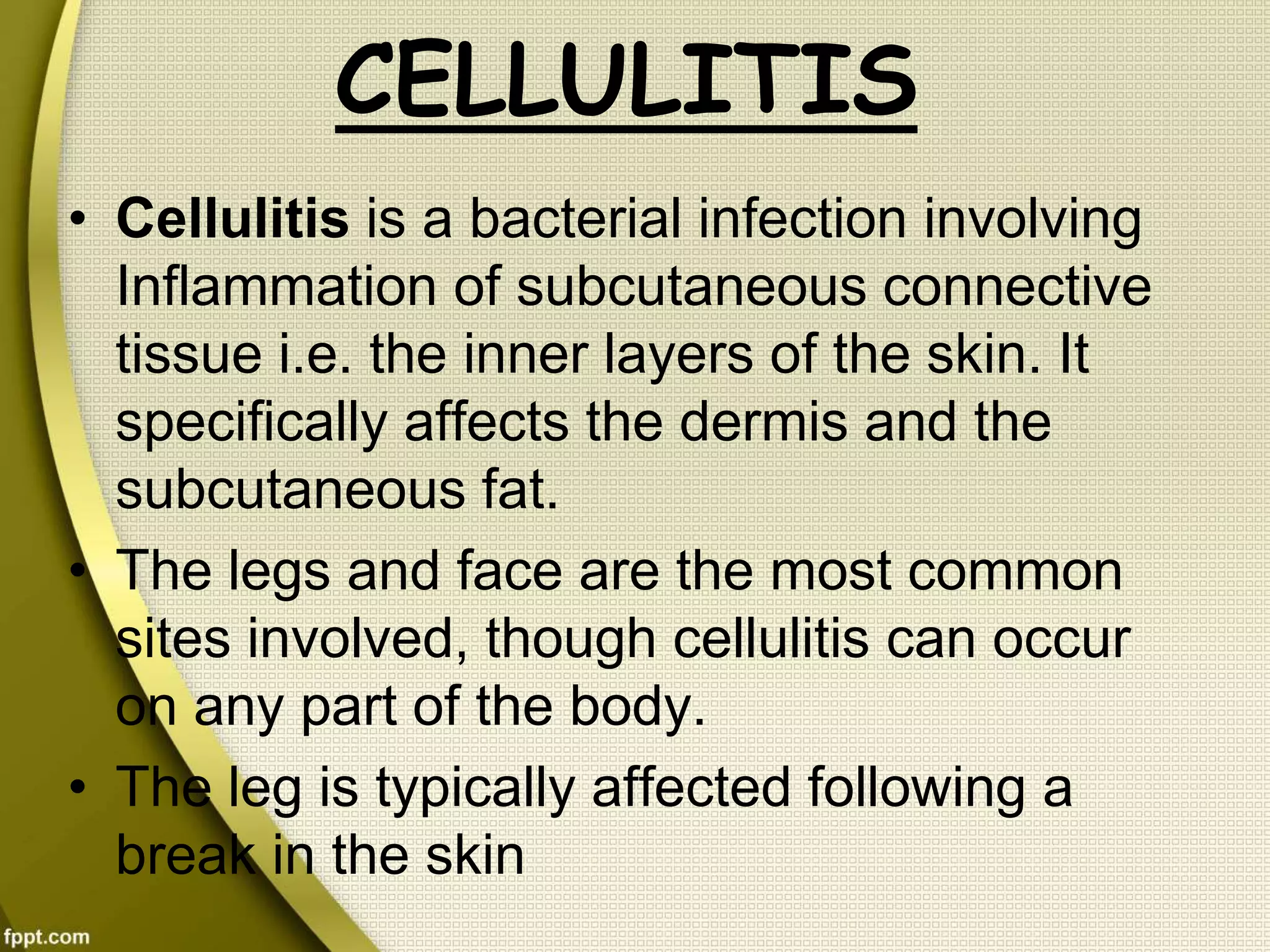 case study on cellulitis | PPT