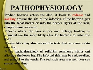 case study on cellulitis | PPT