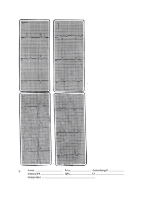 242688837 soal ekg | PDF