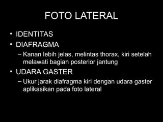 243221265-129577767-Cara-Mudah-Membaca-Rontgen-Thorax-ppt.ppt