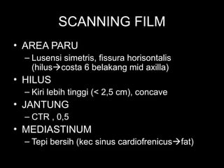 243221265-129577767-Cara-Mudah-Membaca-Rontgen-Thorax-ppt.ppt