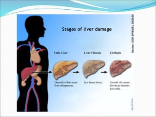 245878517-71351879-ASKEP-SIROSIS-HEPATIS-ppt.ppt