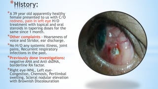 Aggressive Form Of Necrotising Scleritis: First Presentation Of Wegener ...