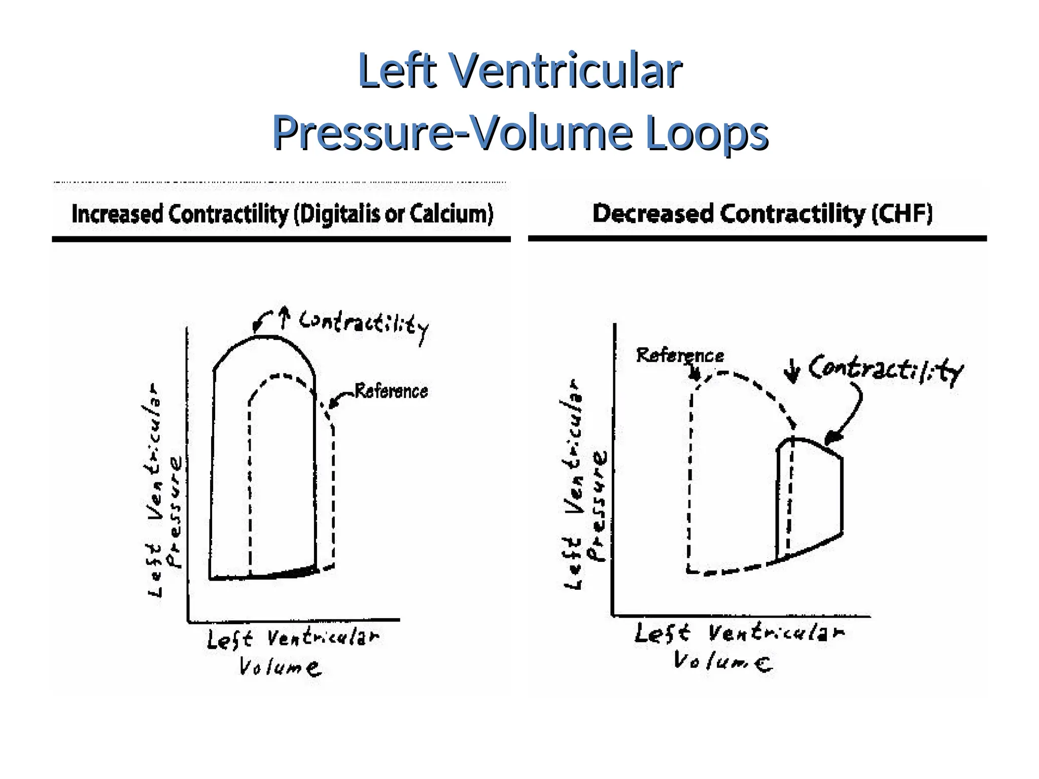 presentation of left ventricular pressure volume loops for dummies | PPT