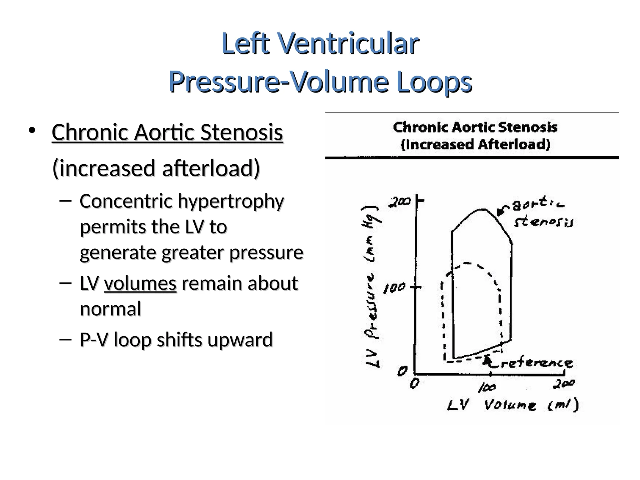 presentation of left ventricular pressure volume loops for dummies | PPT