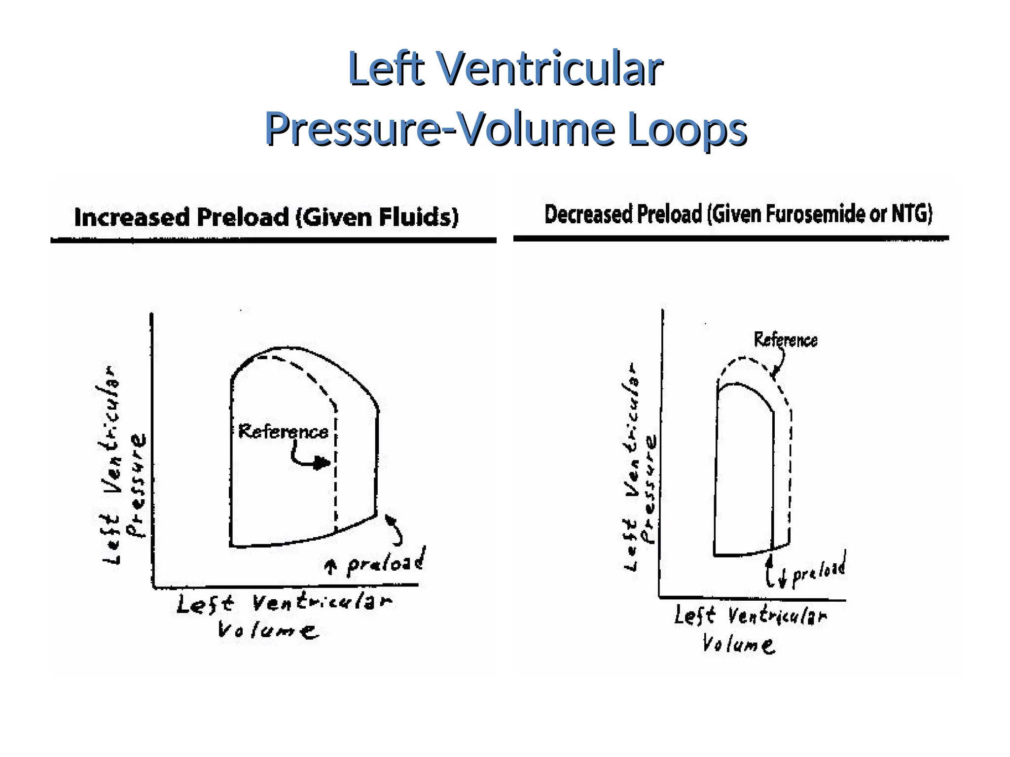 presentation of left ventricular pressure volume loops for dummies | PPT