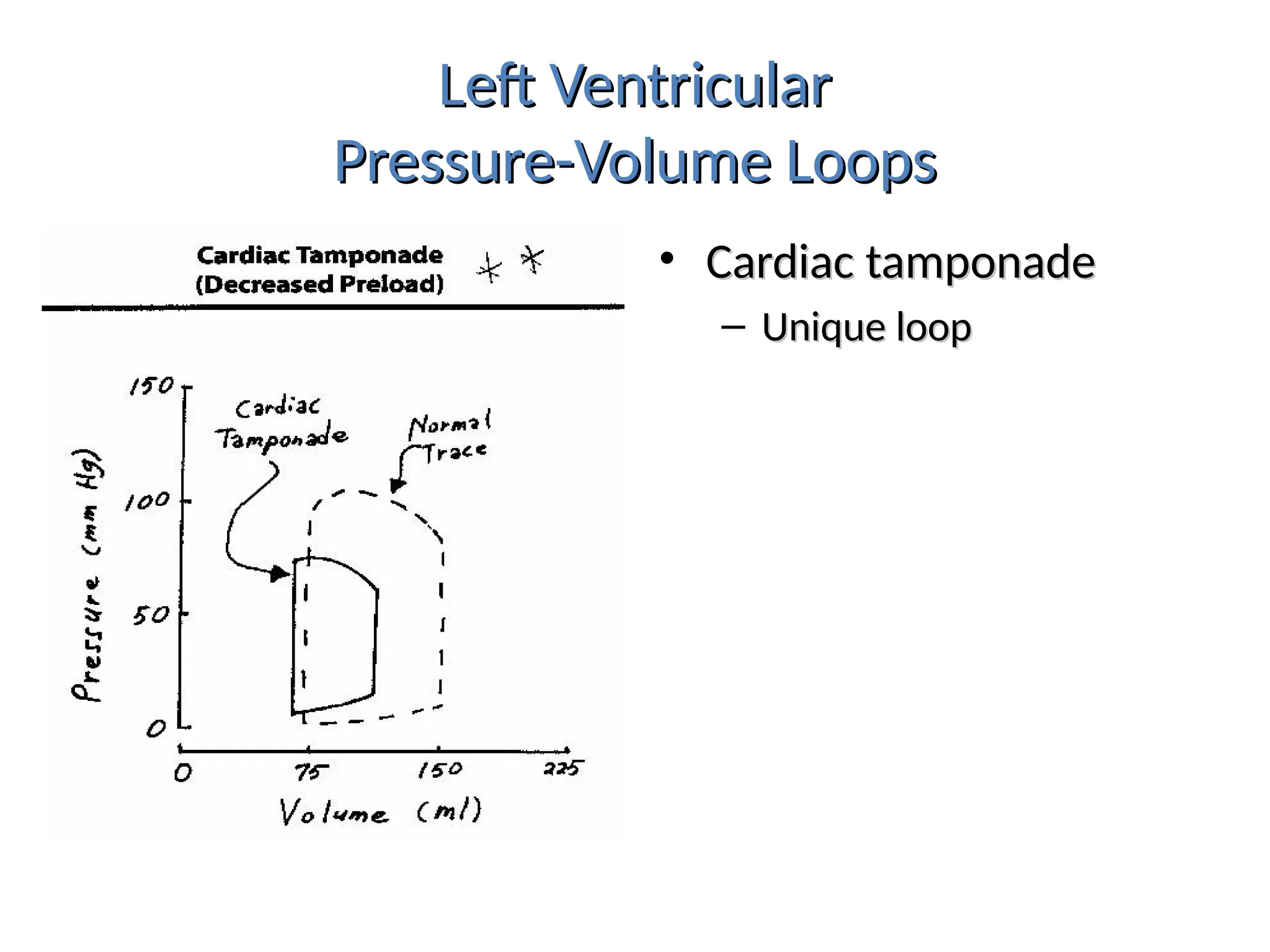 presentation of left ventricular pressure volume loops for dummies | PPT