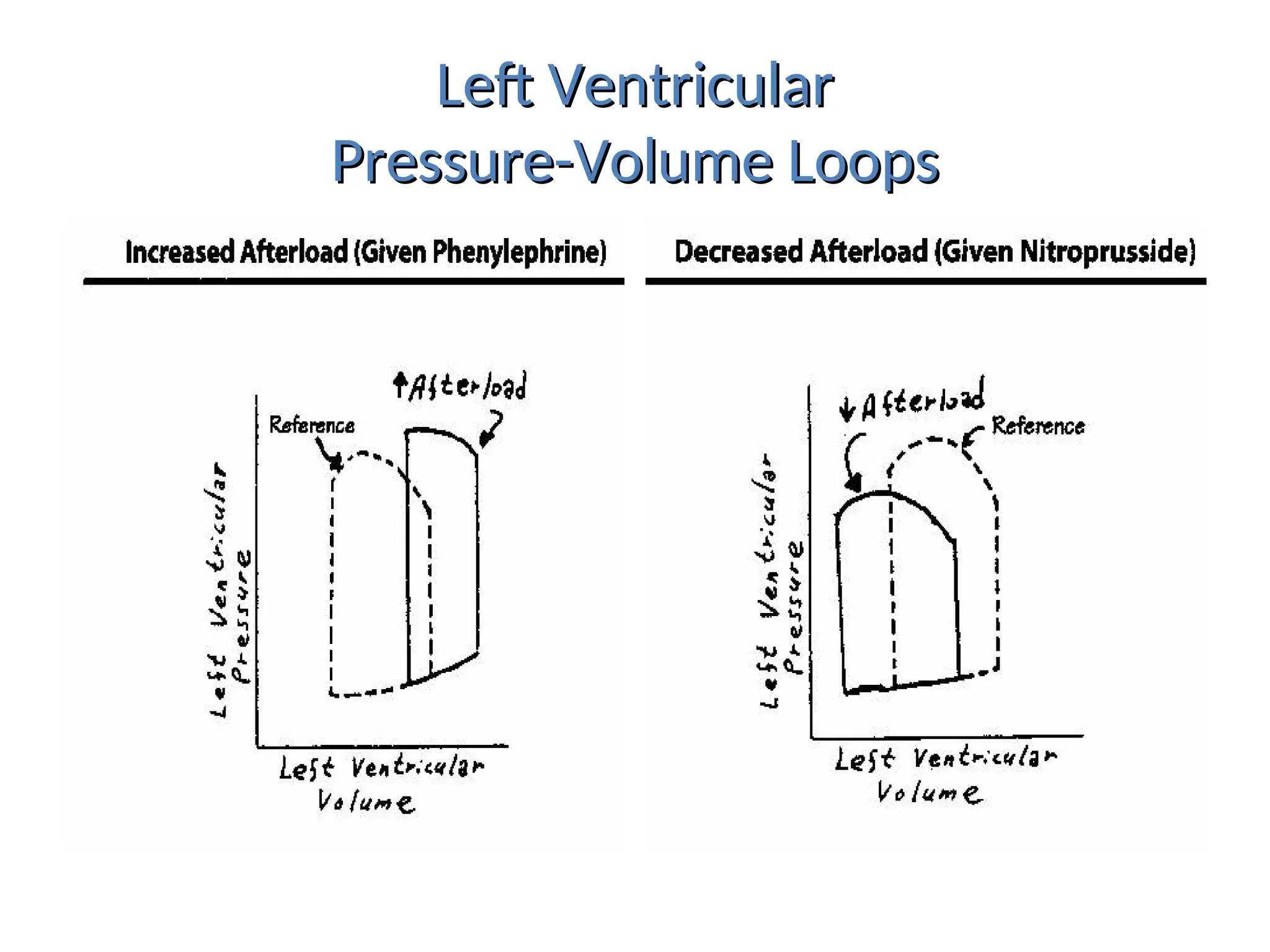 presentation of left ventricular pressure volume loops for dummies | PPT
