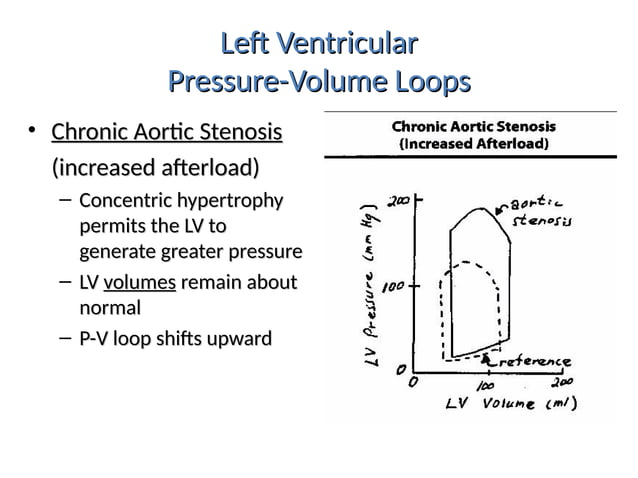 presentation of left ventricular pressure volume loops for dummies | PPT