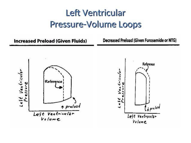 presentation of left ventricular pressure volume loops for dummies | PPT