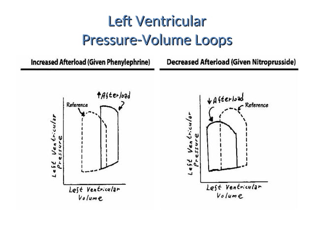 presentation of left ventricular pressure volume loops for dummies | PPT