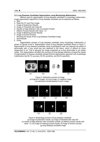 Lung diseases detection caused by smoking using support vector machine ...