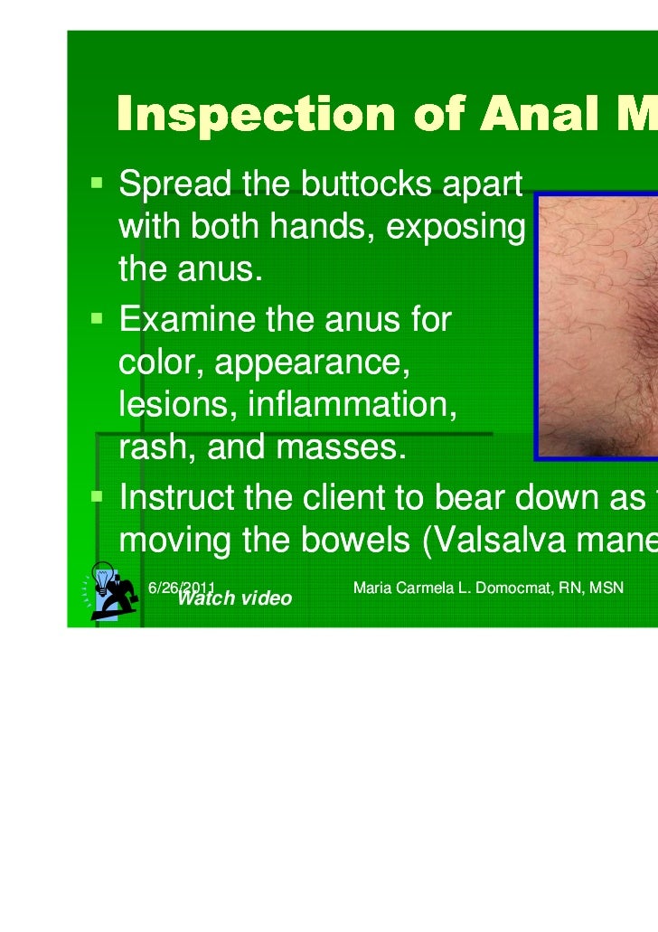 Assessment Of The Anus And Rectum