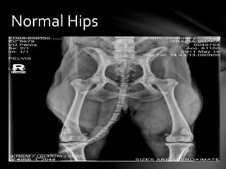 Canine Hip Dysplasia | PPTX