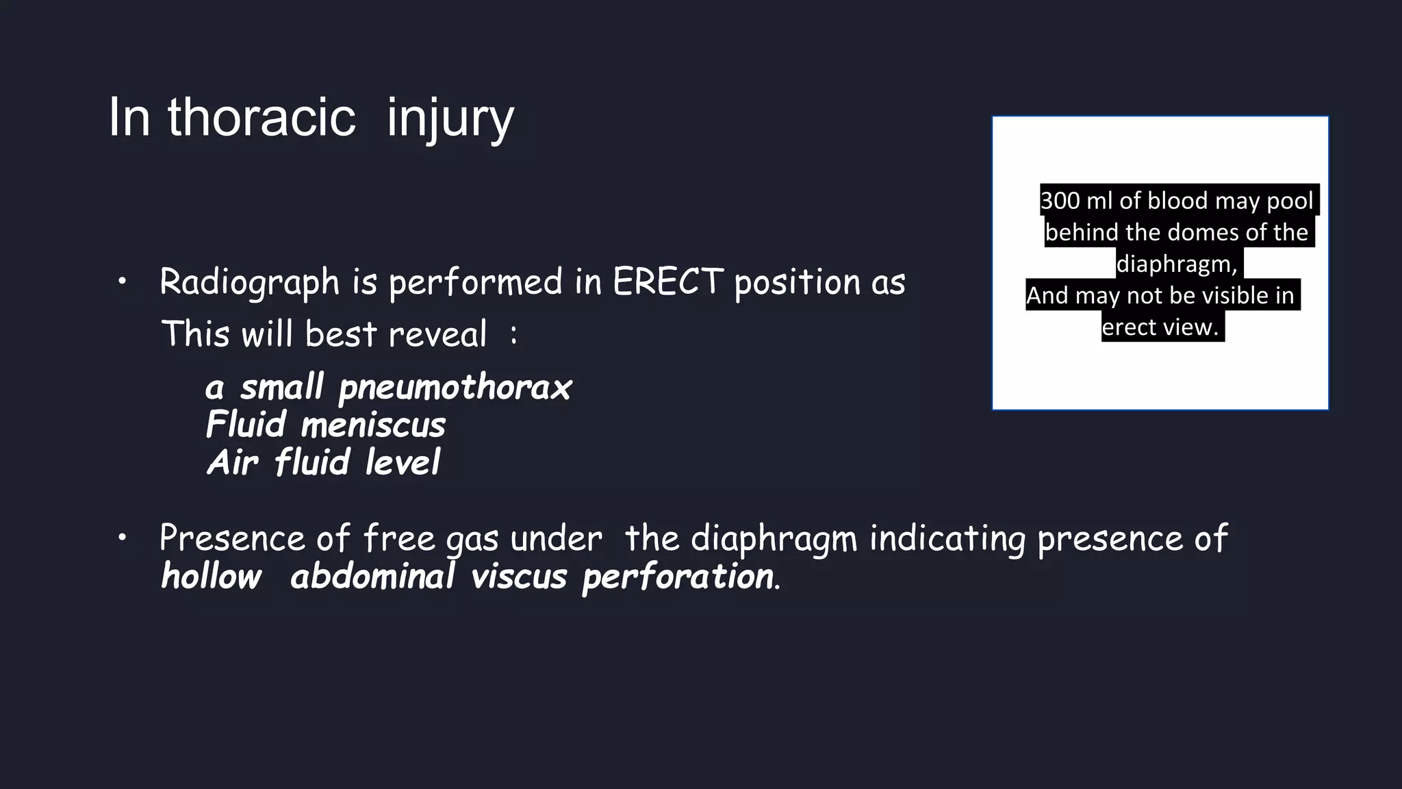 Investigation FOR thoracic trauma | PPTX
