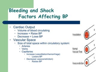 24)Bleeding And Shock | PPT