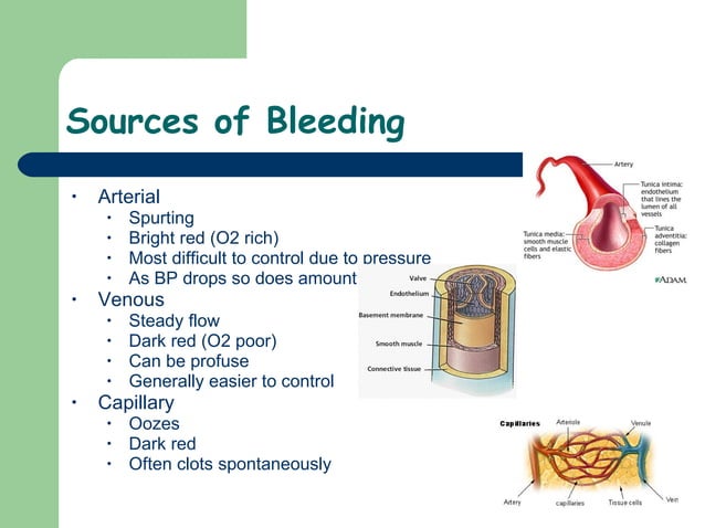 24)Bleeding And Shock | PPT | First Aid | Injuries