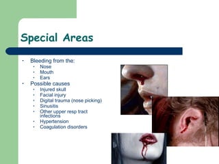 24)Bleeding And Shock | PPT