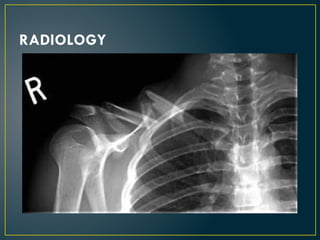 24 CLAVICLE FRACTURES + prox humerus.pptx