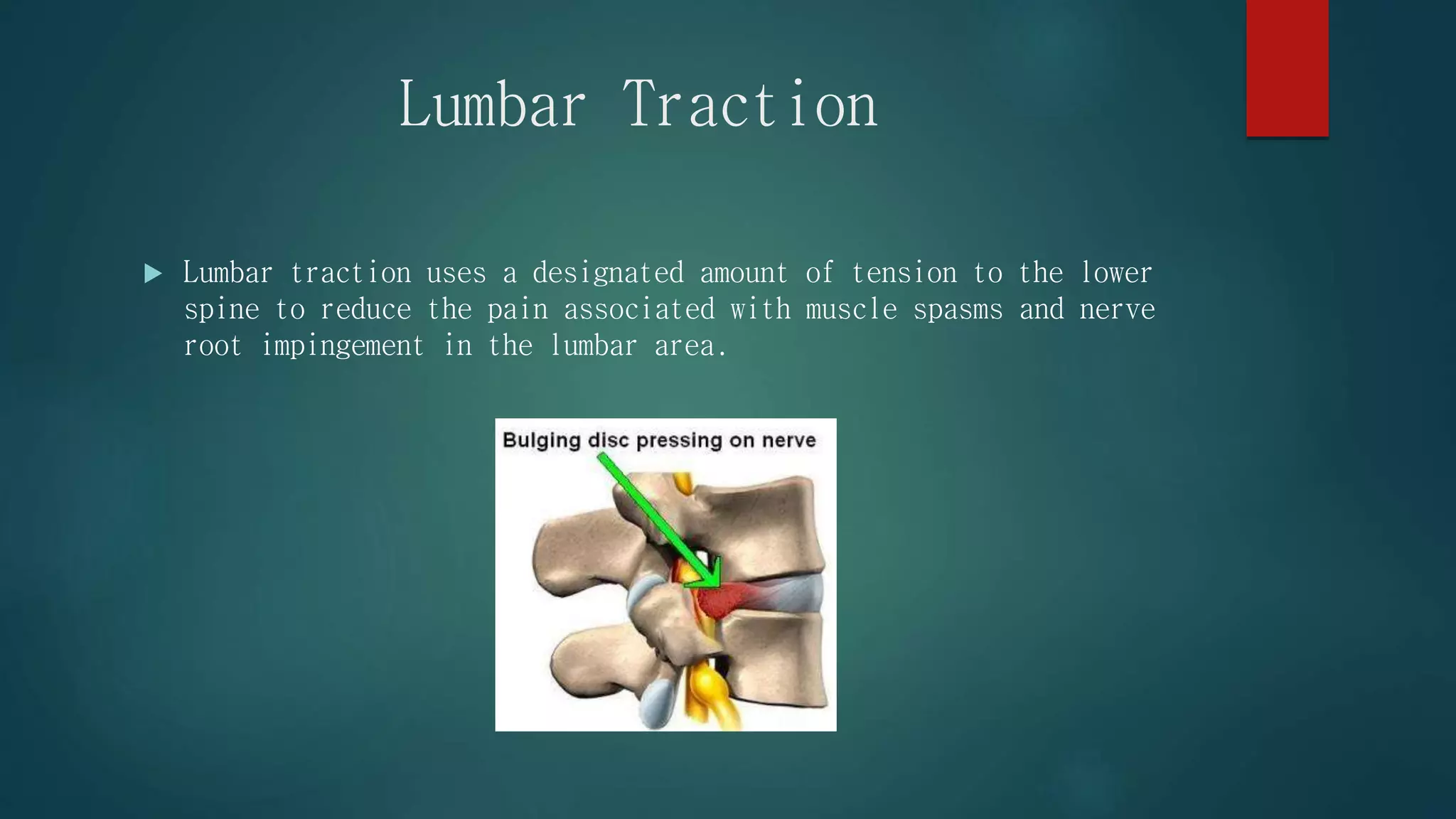 Cervical and Lumbar Traction | PPTX