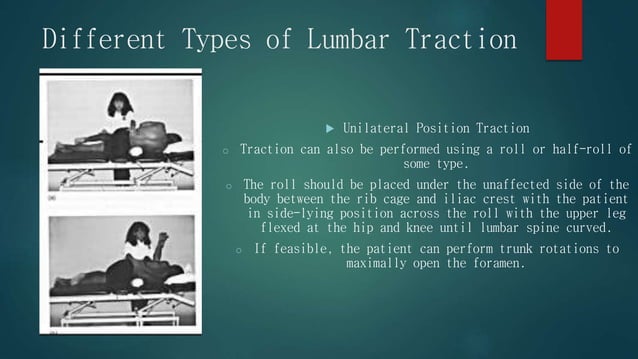 Cervical and Lumbar Traction | PPT