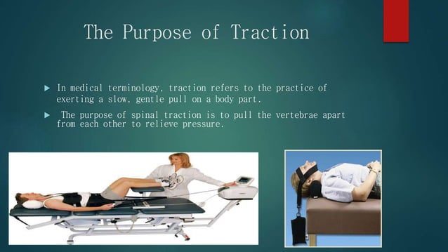 Cervical and Lumbar Traction | PPTX | Death, Injury, or Military Conflict | Sensitive Topics