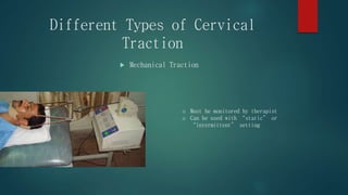 Cervical and Lumbar Traction | PPTX