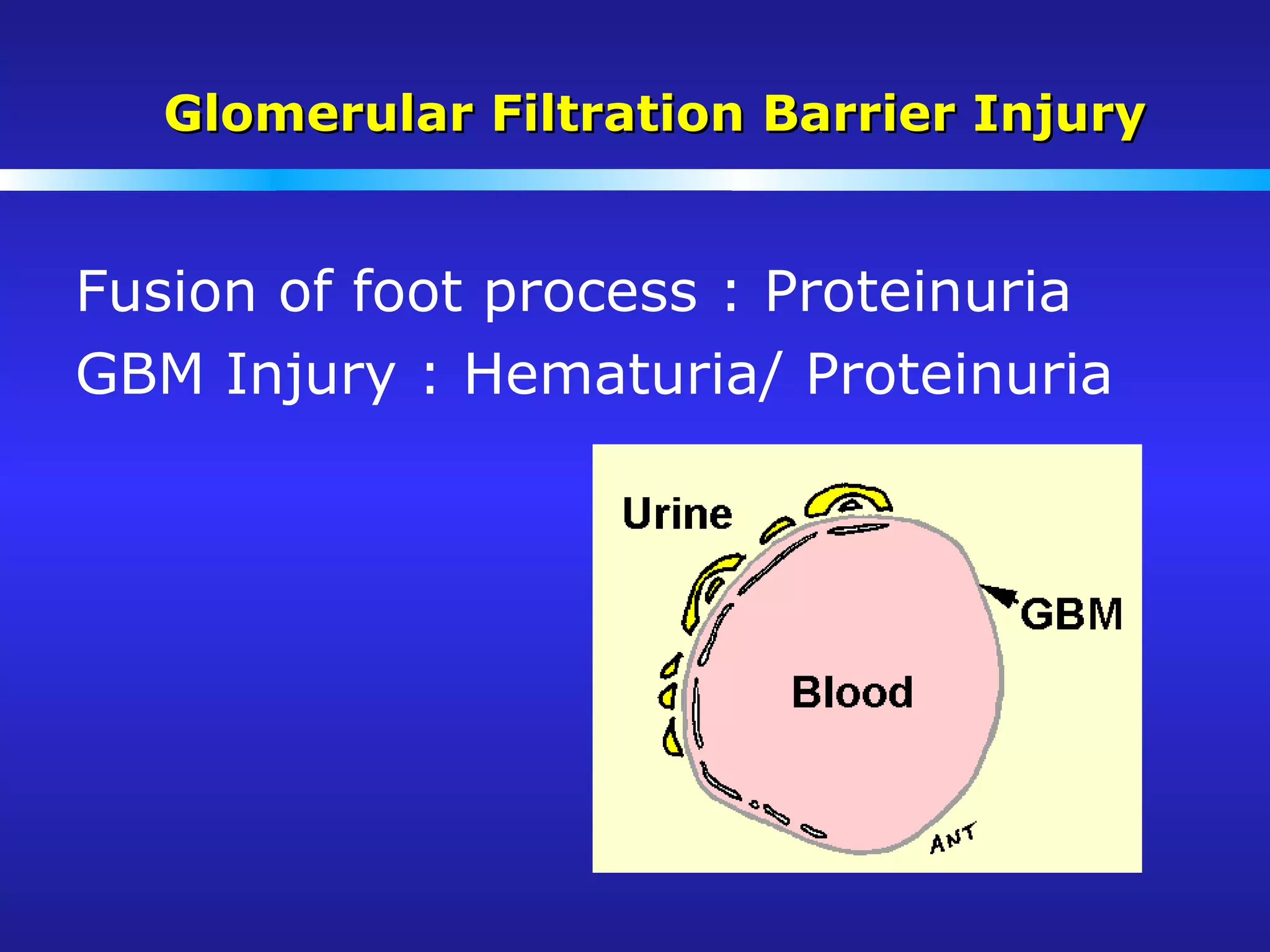 24 glomerular disease | PPT