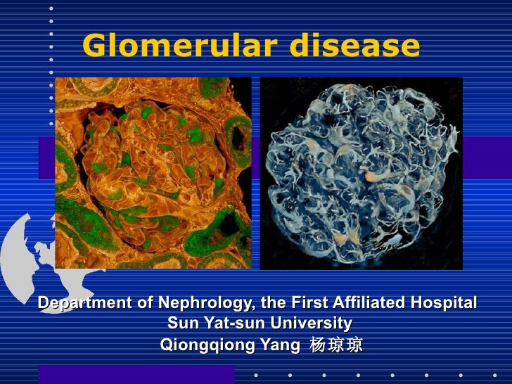 Glomerular Disease
